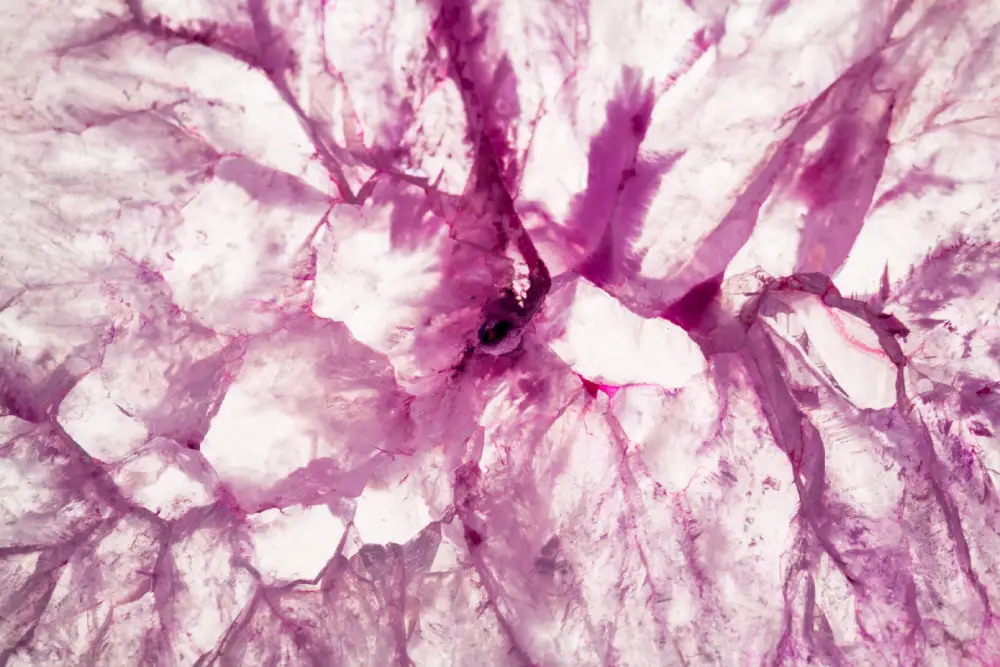Understanding the Thymus Gland: Function, Disorders, and Treatment ...